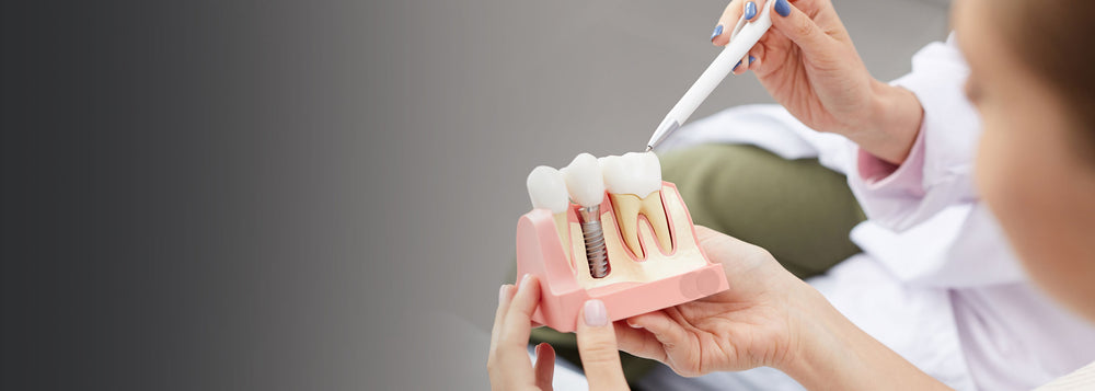 Dental Implants at Marsh House Specialist Dentists
