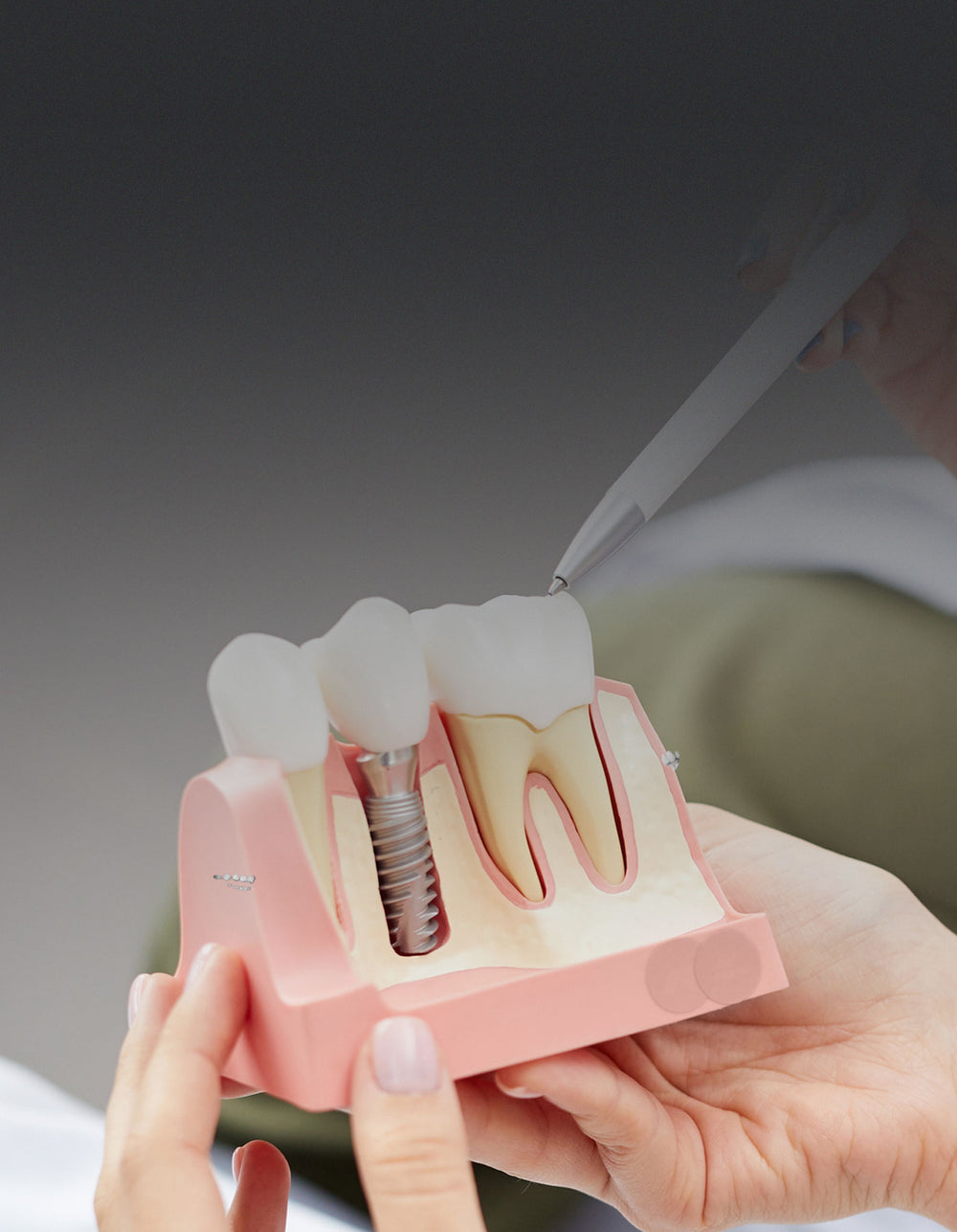 Dental Implants at Marsh House Specialist Dentists